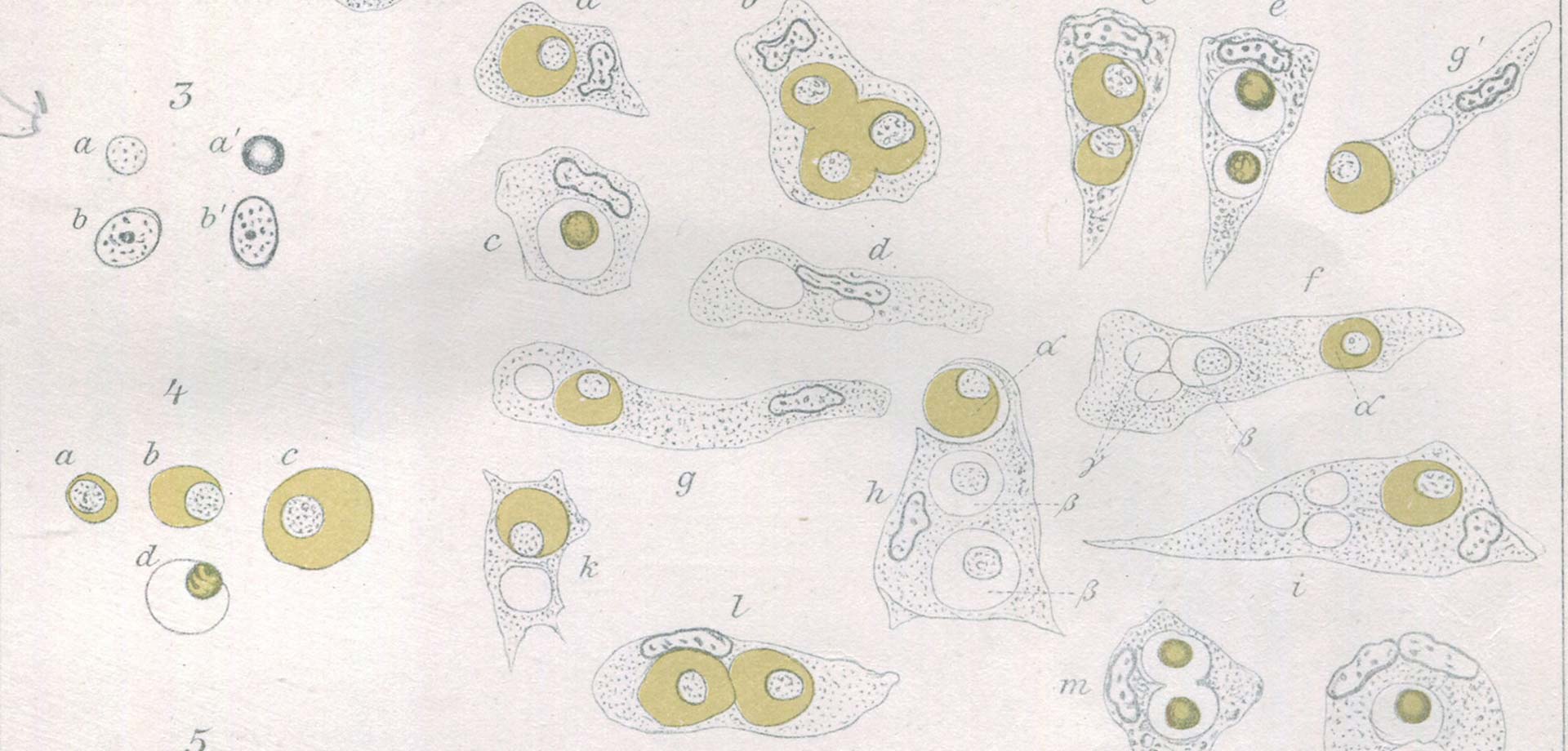 Pathology - Ernst Neumann Hematologist Königsberg
